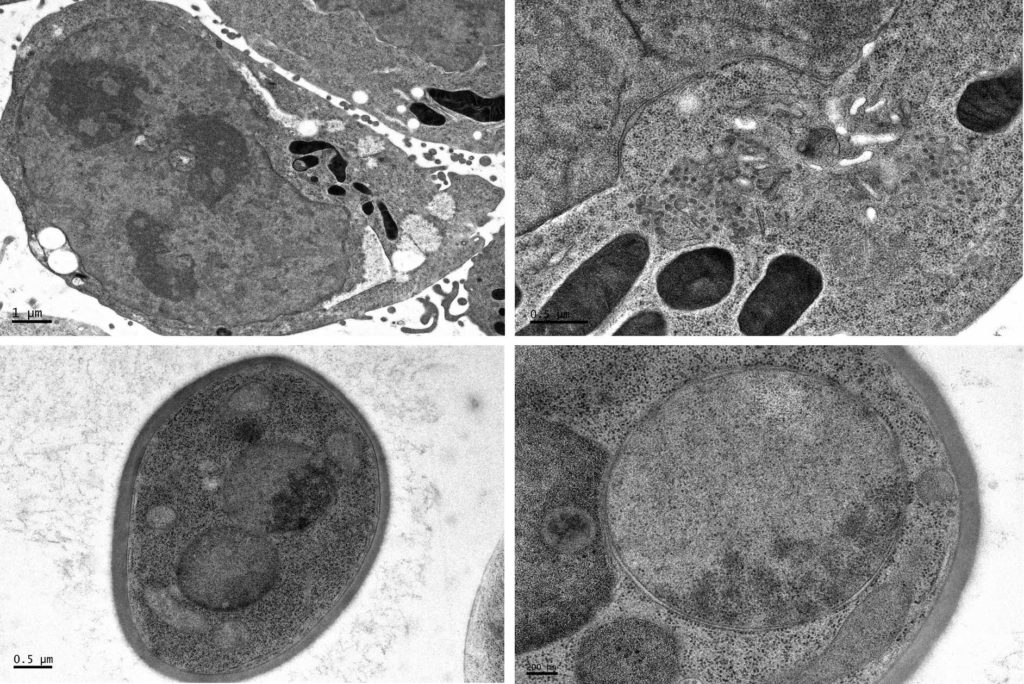Cryofixateur haute pression - TRI-Genotoul